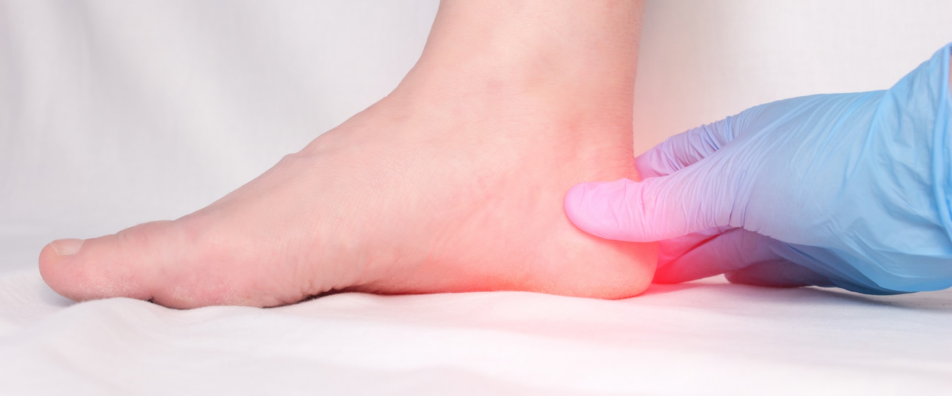 Understanding Plantar Fasciitis: Causes, Symptoms, and Treatment Options